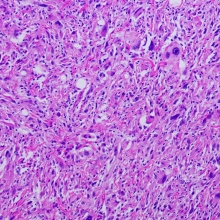 Christina L. Roland | MD Anderson Cancer Center