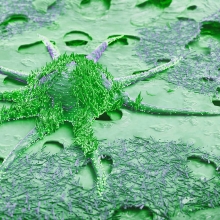 Funda Meric-Bernstam | MD Anderson Cancer Center