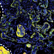 Humam Kadara | MD Anderson Cancer Center