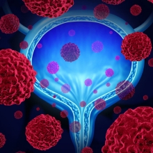 Padmanee Sharma | MD Anderson Cancer Center