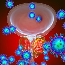 Sumit K Subudhi, M.D., Ph.D. | MD Anderson Cancer Center