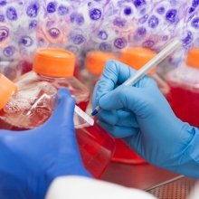 Paolo Strati | MD Anderson Cancer Center