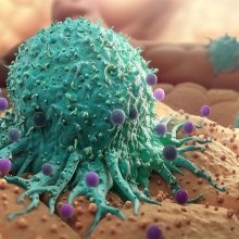 Jason Aboudi Mouabbi | MD Anderson Cancer Center